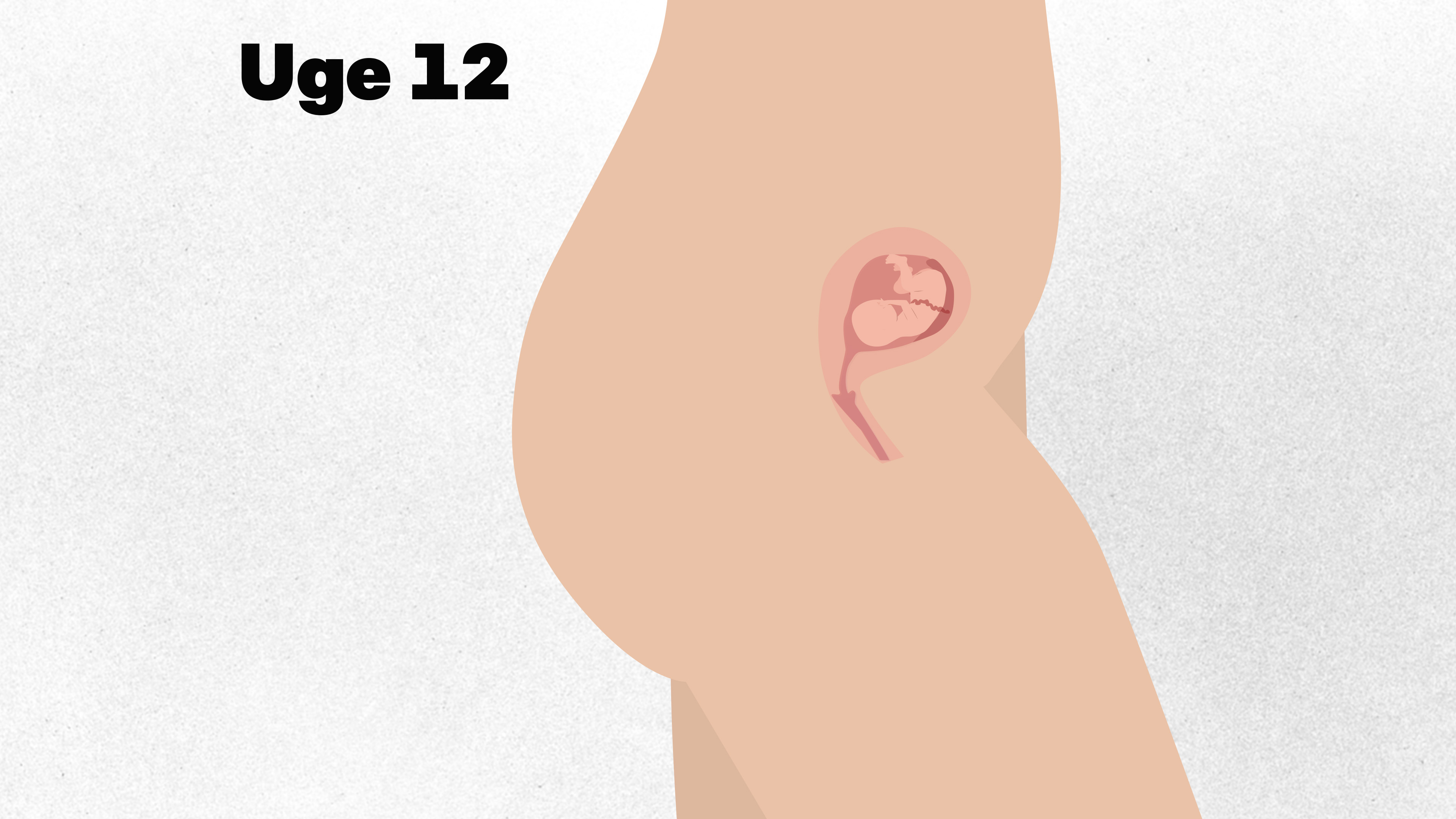 Jordemoder: En abort må gerne følge kvinden - men aldrig forfølge hende | Indland | DR