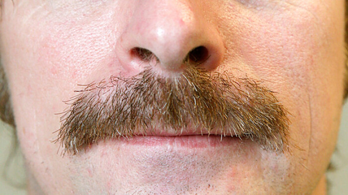 Overskægget handler om mænds sundhed | Krop | DR