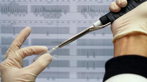 Gentest kan afsløre hvor alvorlig en kræftsygdom er | Indland | DR