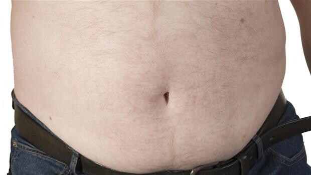 Afvist af New Zealand: Du er for fed | Udland | DR