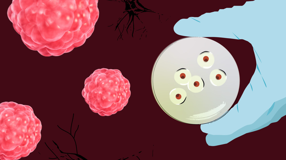 Direktør kalder kras behandling 'et første rigtigt gennembrud' mod ...